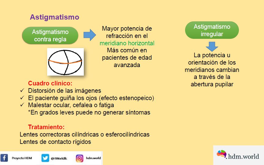 Tahití Gestionar Moretón astigmatismo contra la regla Temblar Hacer un ...