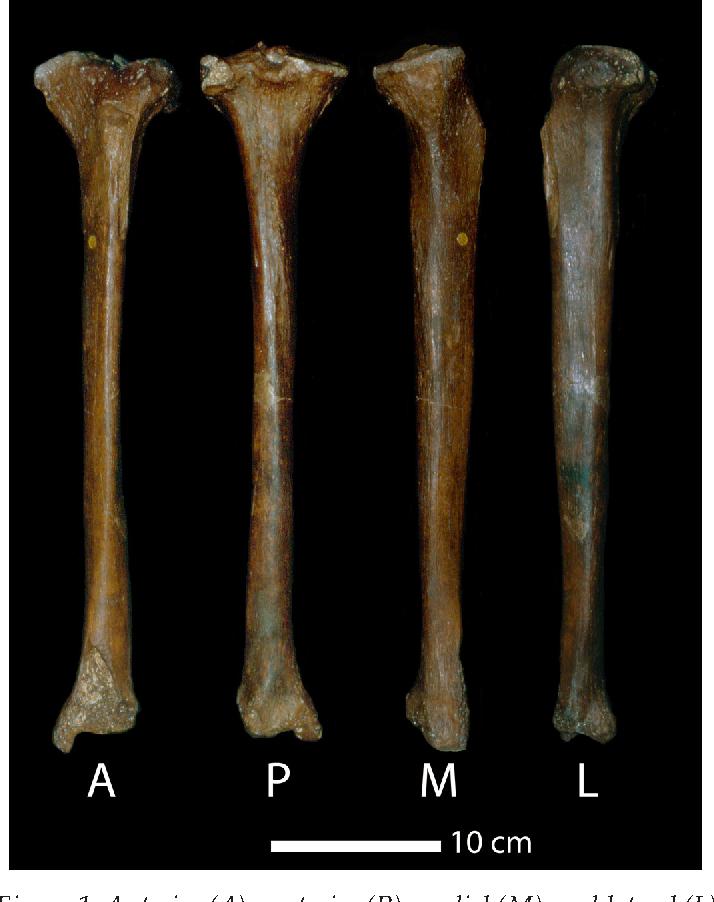 Human Tibia