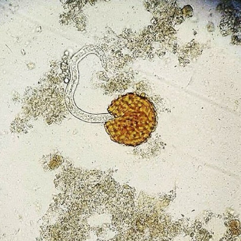 Larvas De Ascaris Lumbricoides