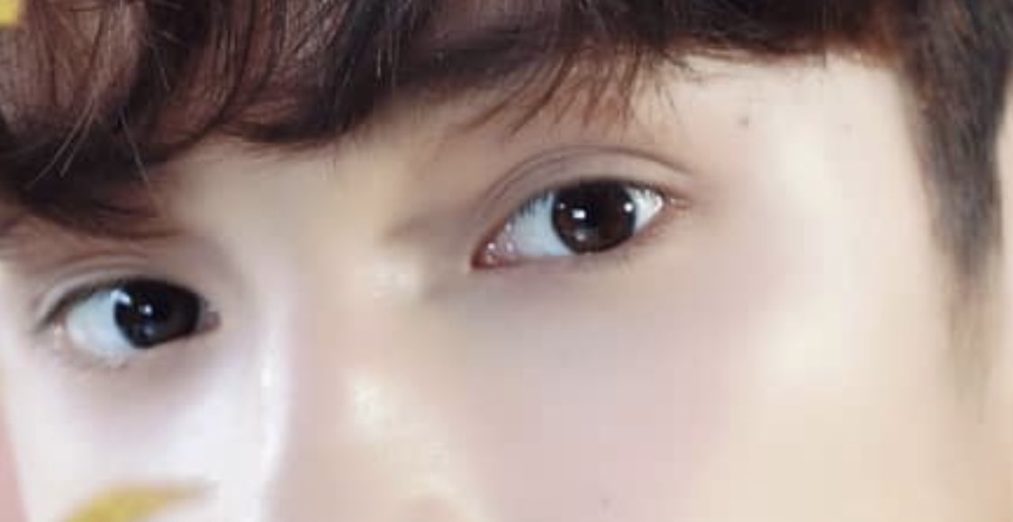 Triple Eyelid