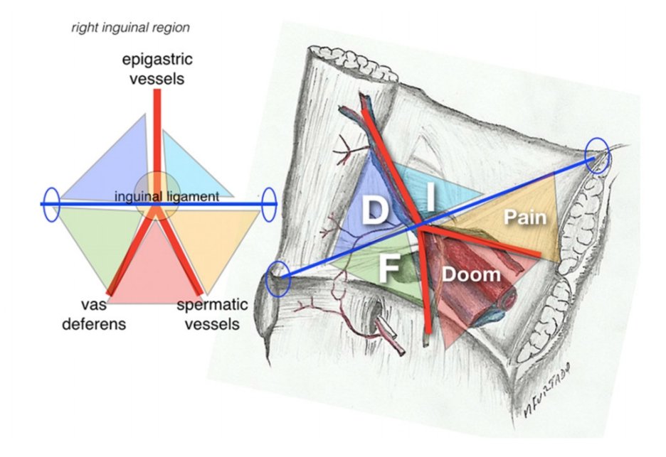 Disección Del Triángulo Femoral
