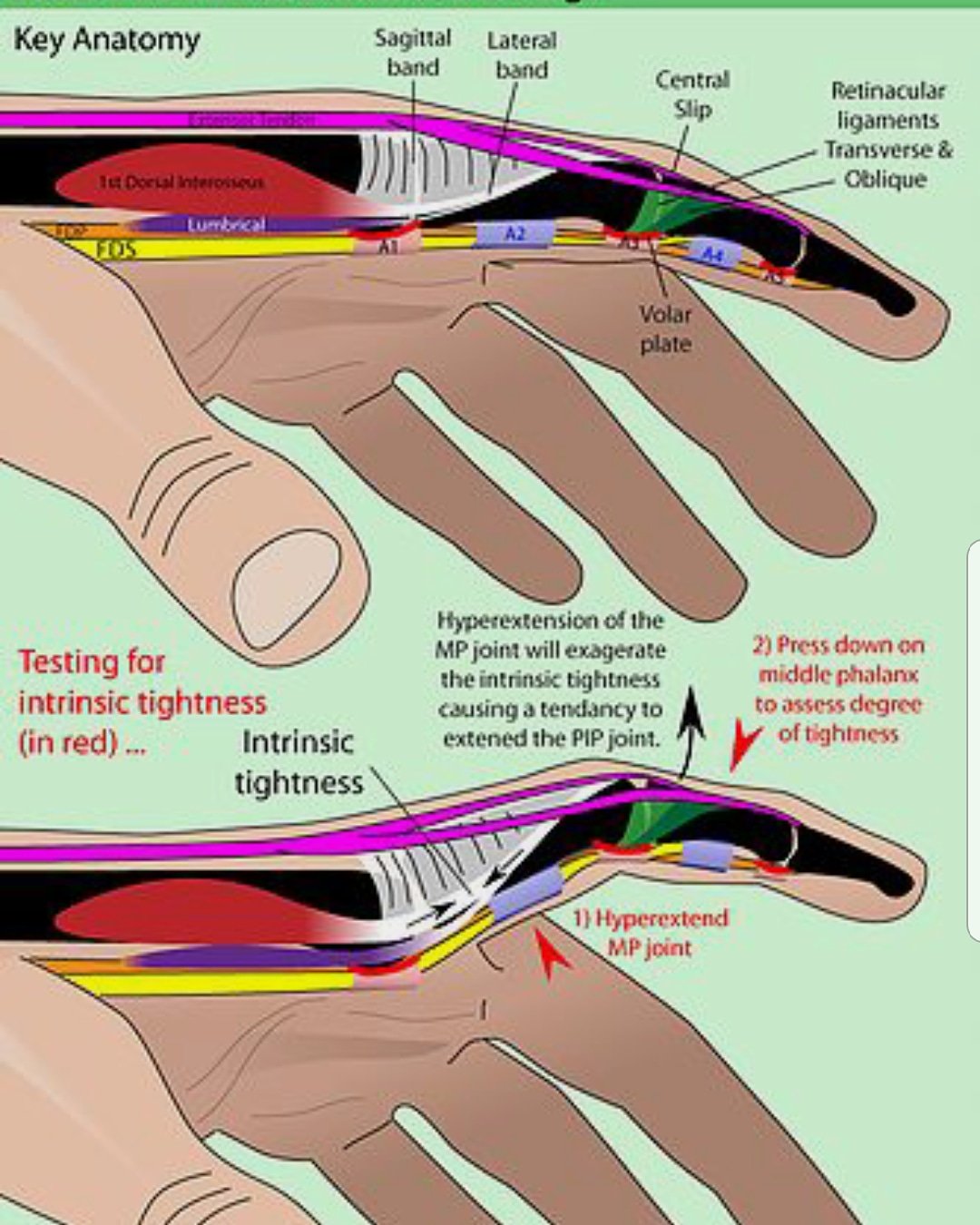 Metacarpophalangeal Joint Flexion