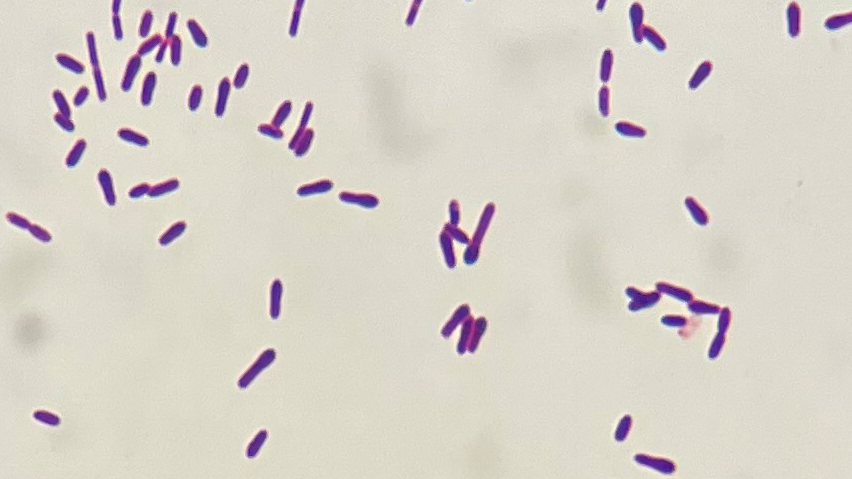 Clostridium Tetani Spores