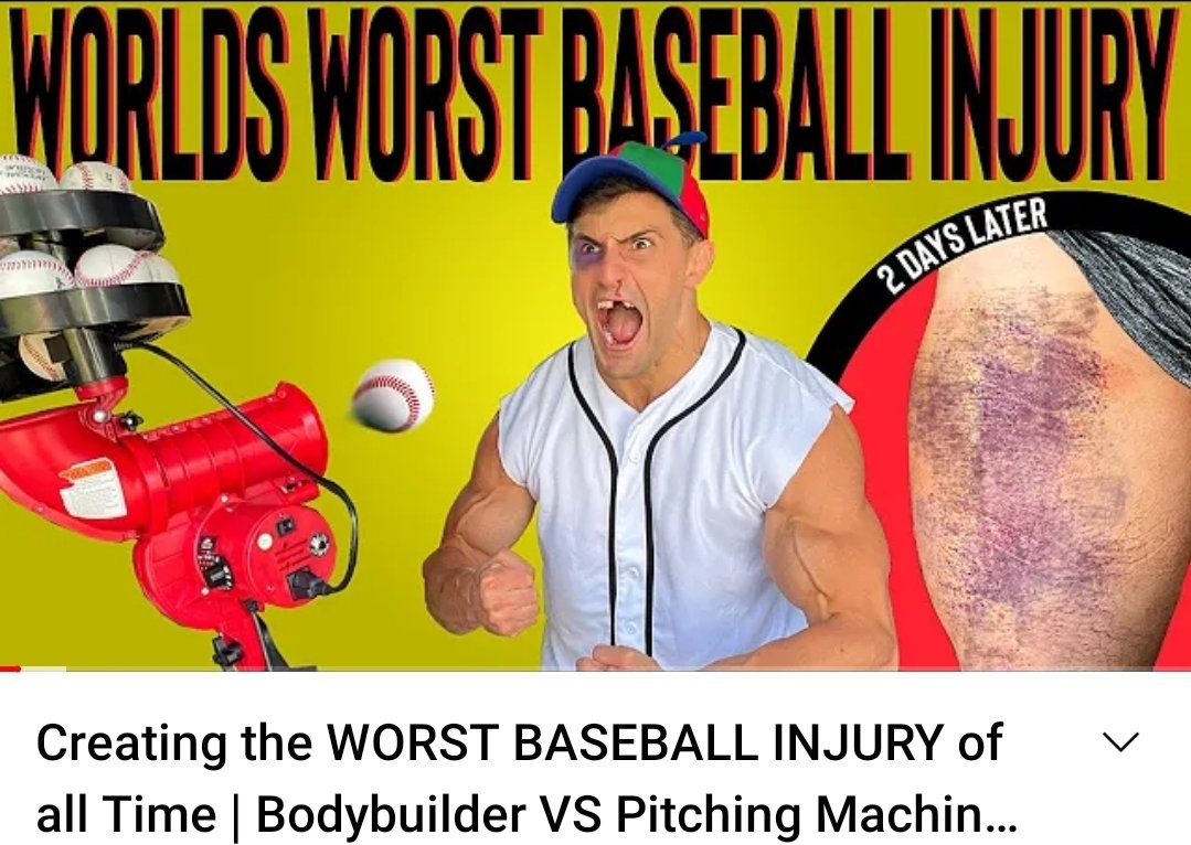 Worst Baseball Injuries
