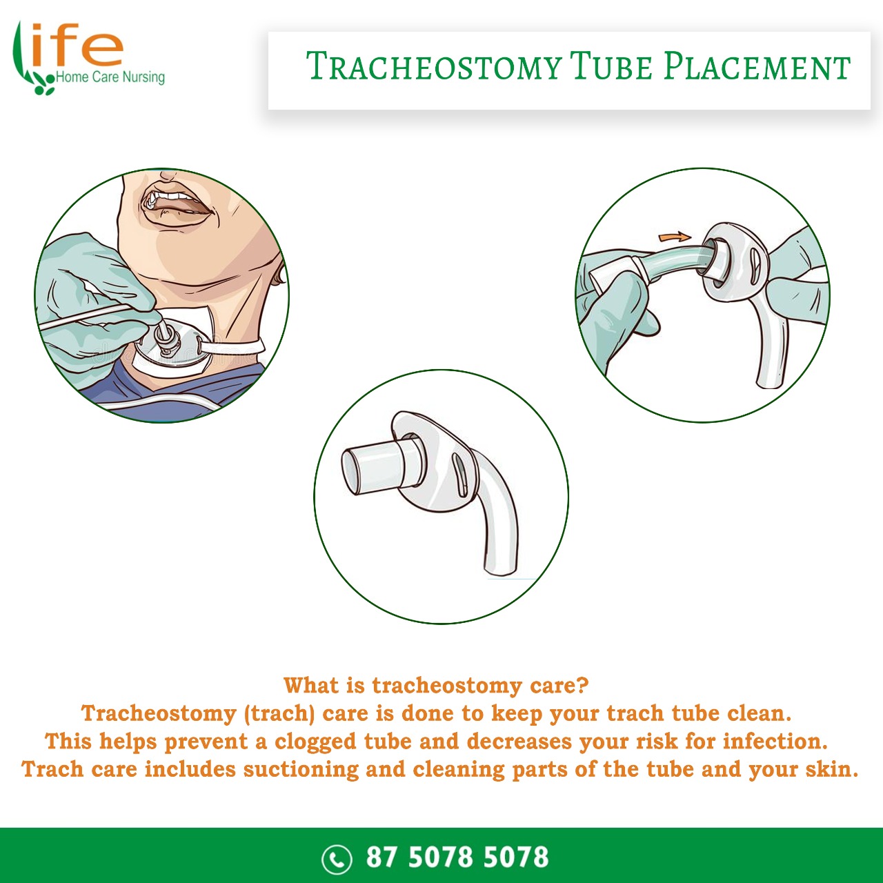 Tracheostomy Cleaning