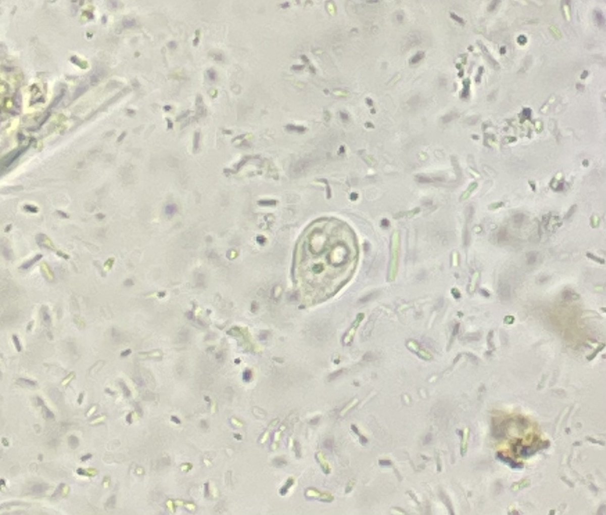 Trofozoíto De Giardia Lamblia