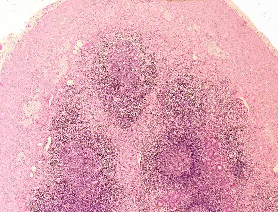 Appendix Histology Diagram