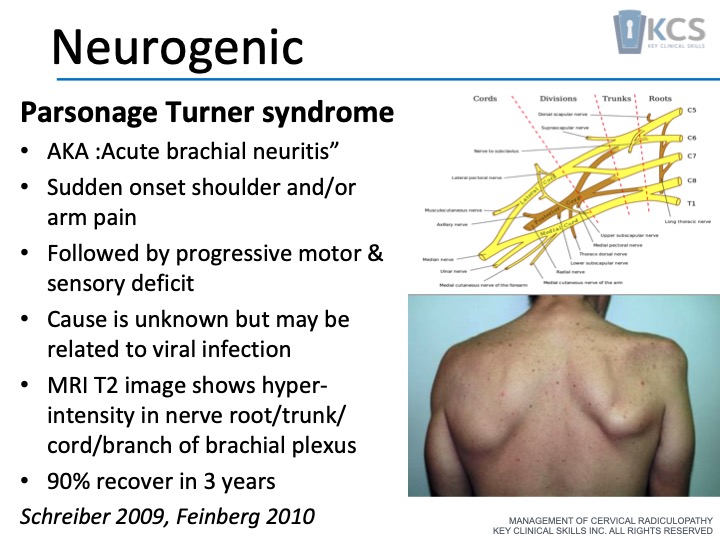 Turner Syndrome Symptoms