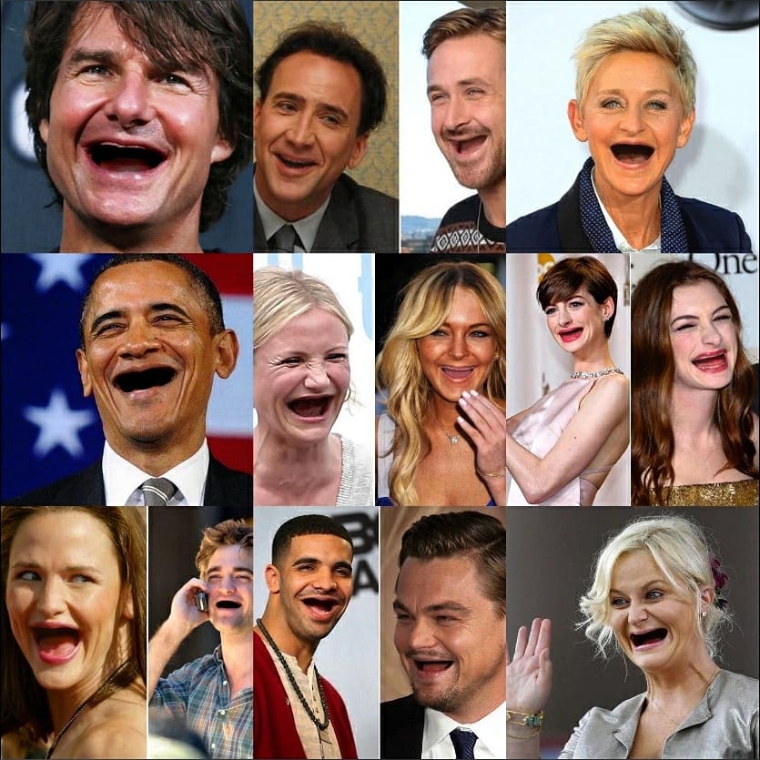Celebrities No Teeth Collage
