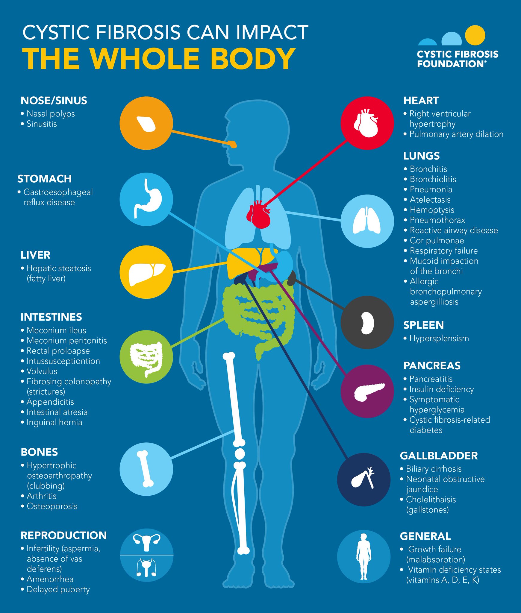 Cystic Fibrosis Foundation on Twitter: "Cystic fibrosis affects more ...