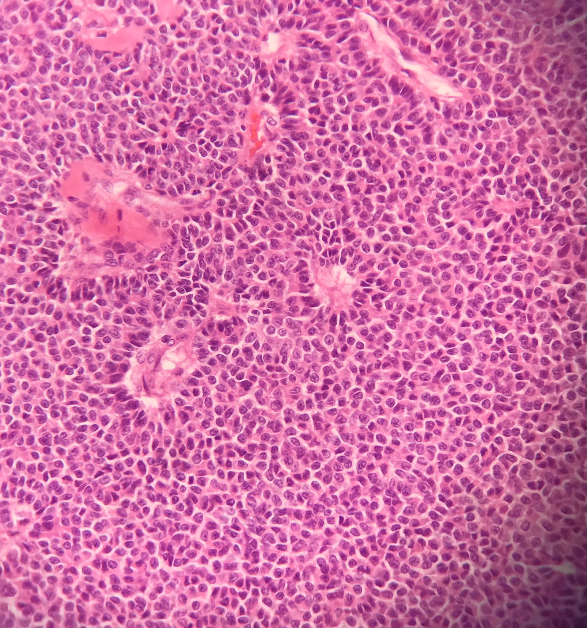 Human Liver Cells Under Microscope