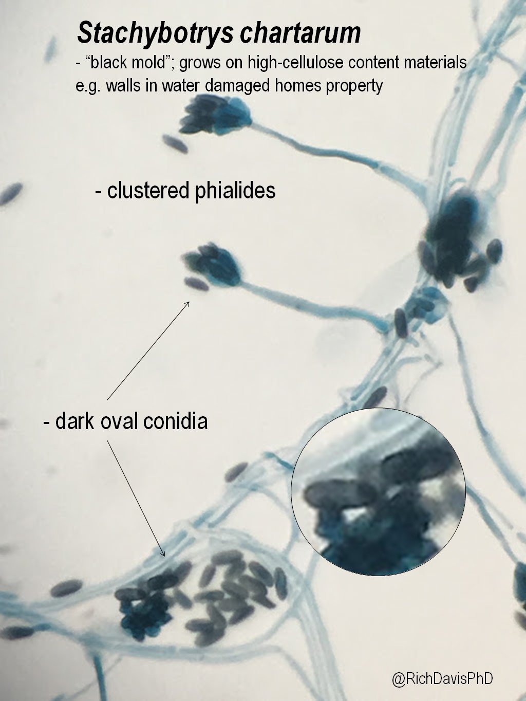Water Molds Under Microscope