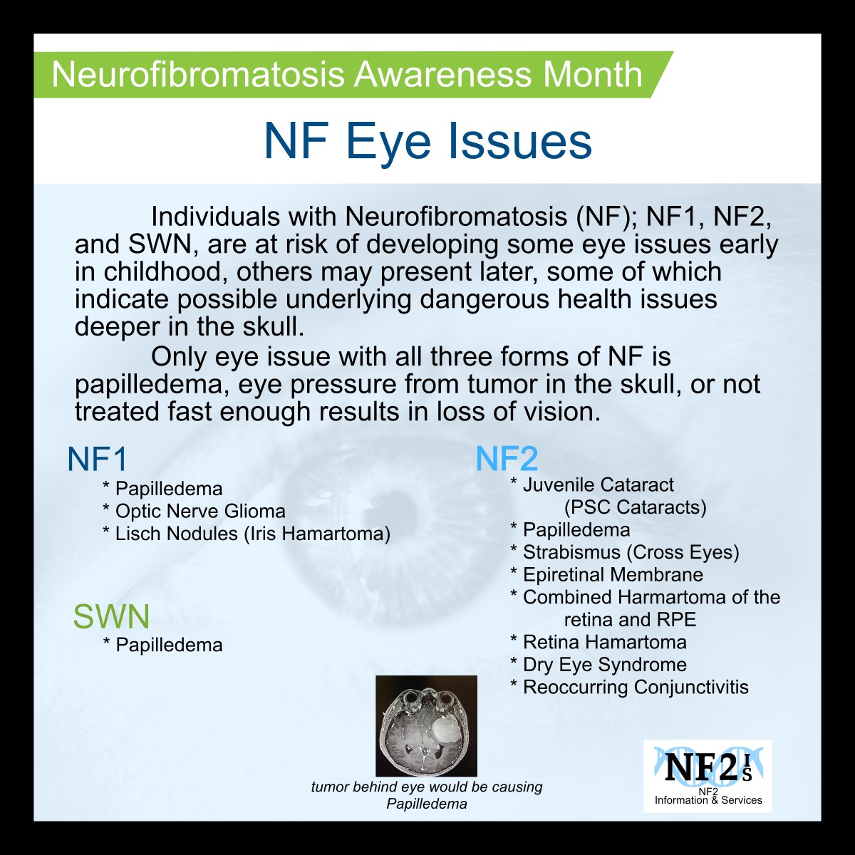 Neurofibromatosis Type 1 Eye