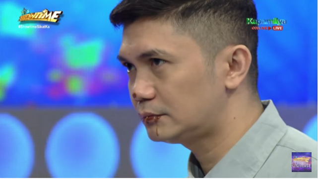 Vhong Navarro Hairstyle 2022 In Showtime