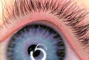 Double Eyelashes Mutation