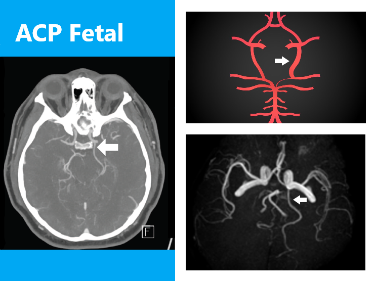 🥈#tweetorial de la serie #NoMasNeurofobia en español. REGIONES ...