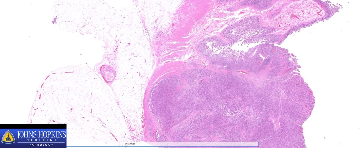 Quem Nasce Em Setembro E De Que Signo 22