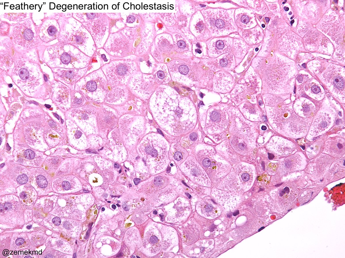 Hepatocytes Histology