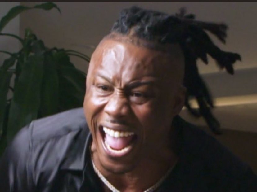 J Cole Teeth