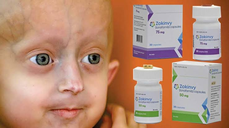 Lonafarnib Progeria