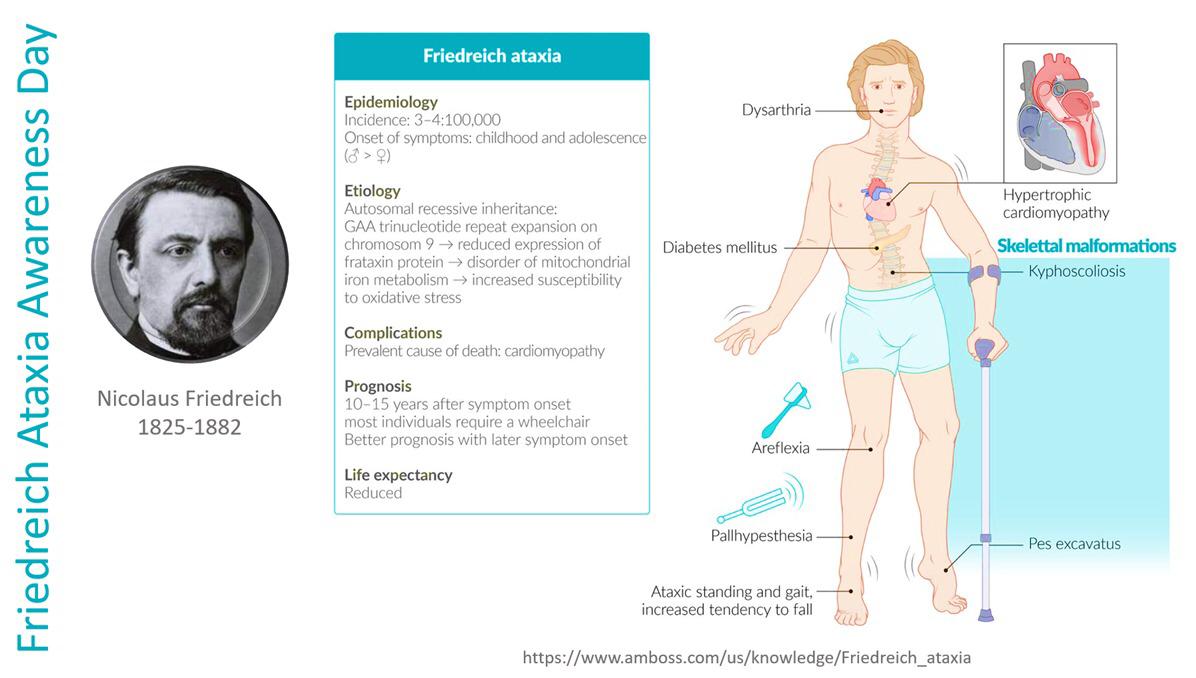 Friedreich Ataxia