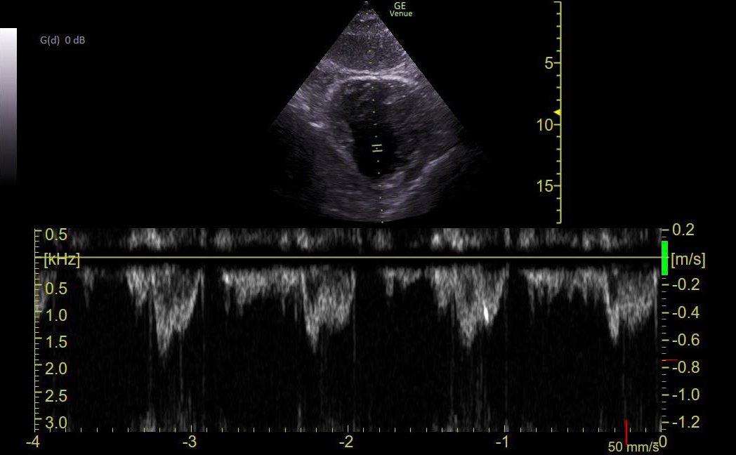 Another one for the AKI Consult series 🧵: 👵 w group 4 Pulmonary ...