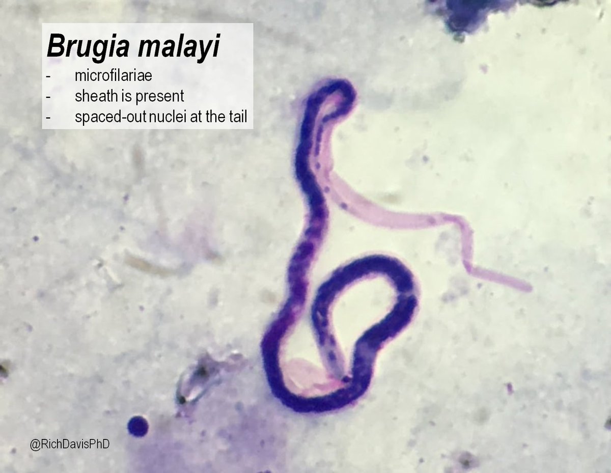 Brugia Malayi Microfilariae