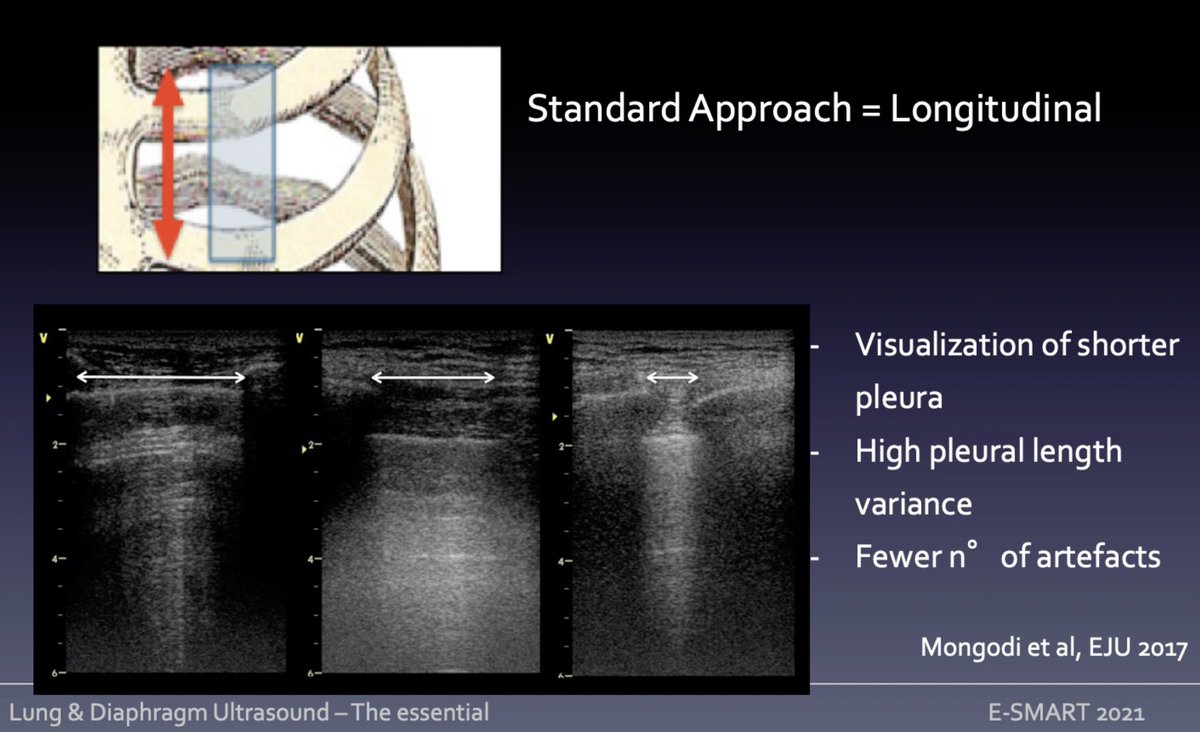 Essential of lung/diaphragm #POCUS tutorial 🧵 🦇 sign identify lung in ...