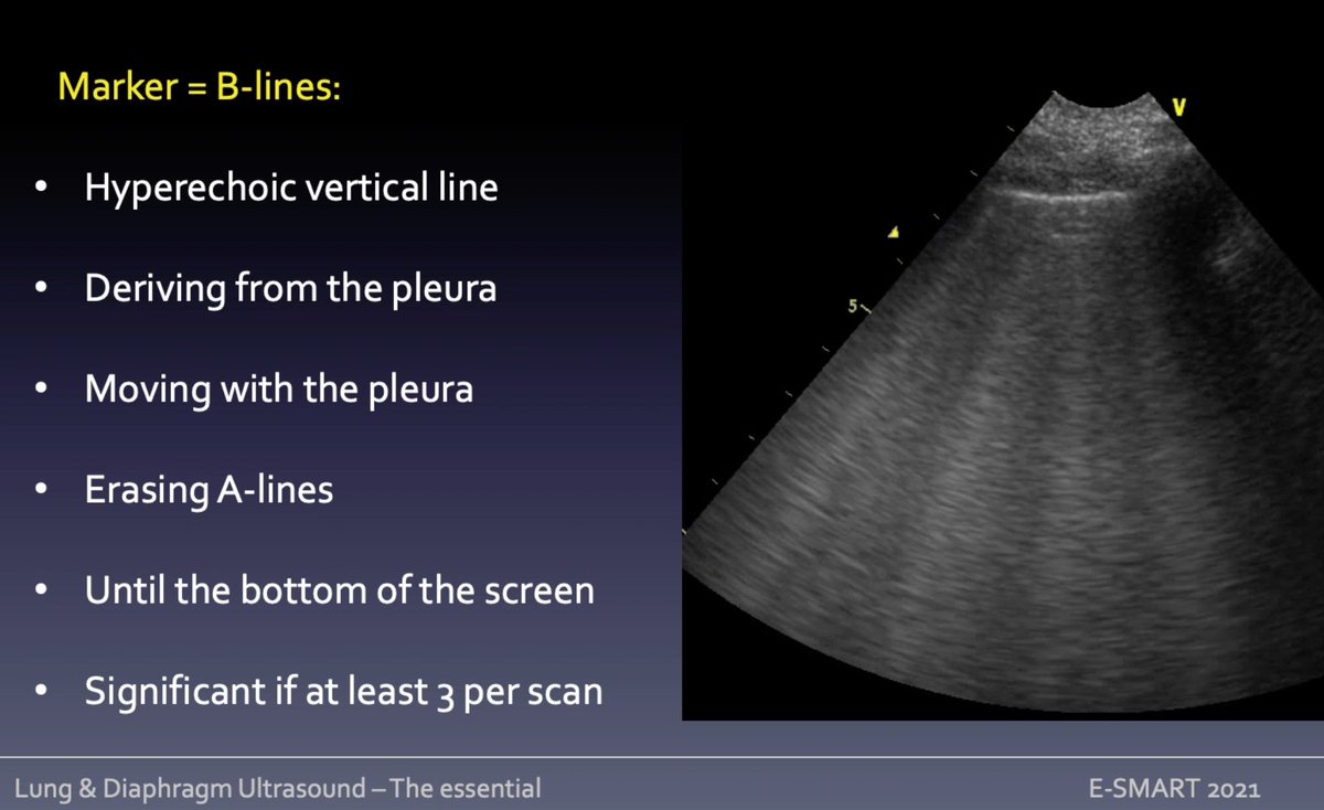 Essential of lung/diaphragm #POCUS tutorial 🧵 🦇 sign identify lung in ...