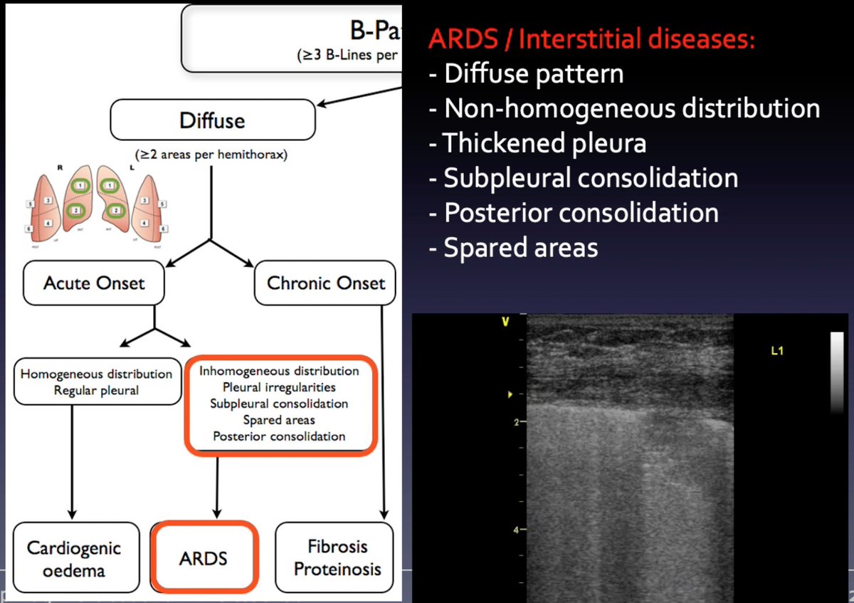 Essential of lung/diaphragm #POCUS tutorial 🧵 🦇 sign identify lung in ...