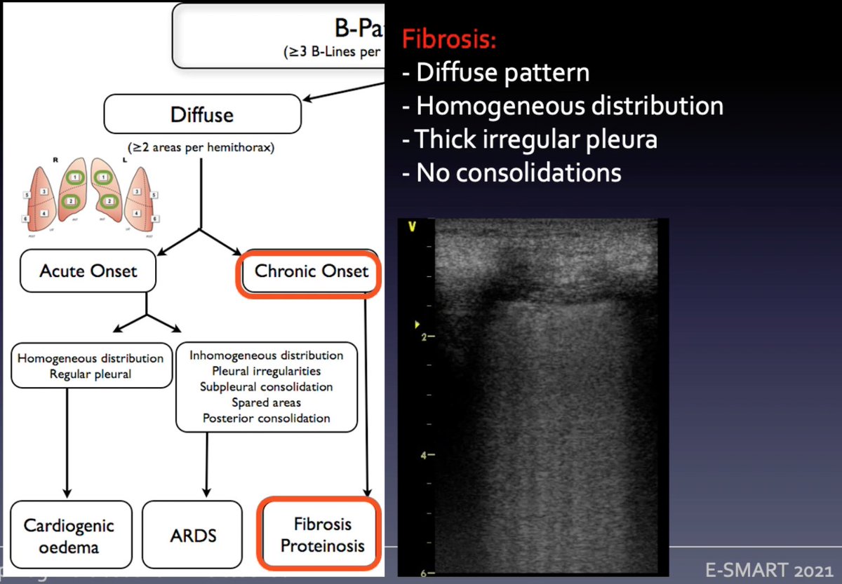 Essential of lung/diaphragm #POCUS tutorial 🧵 🦇 sign identify lung in ...