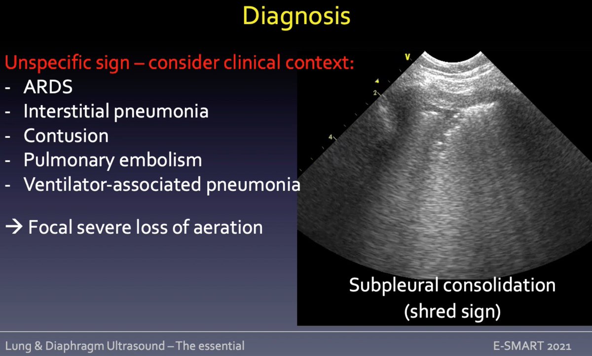 Essential of lung/diaphragm #POCUS tutorial 🧵 🦇 sign identify lung in ...