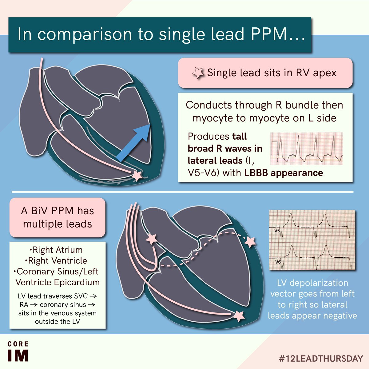1/ goooooood morning, #MedTwitter, and happy #12LeadThursday-on-a ...