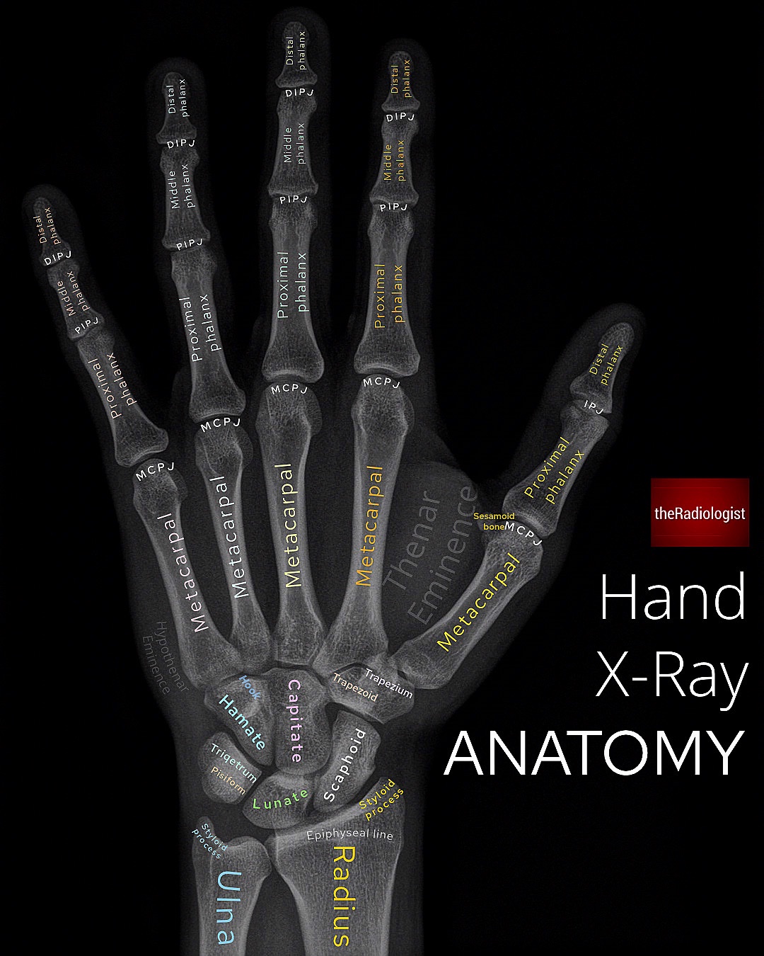 Xray Hand Anatomy