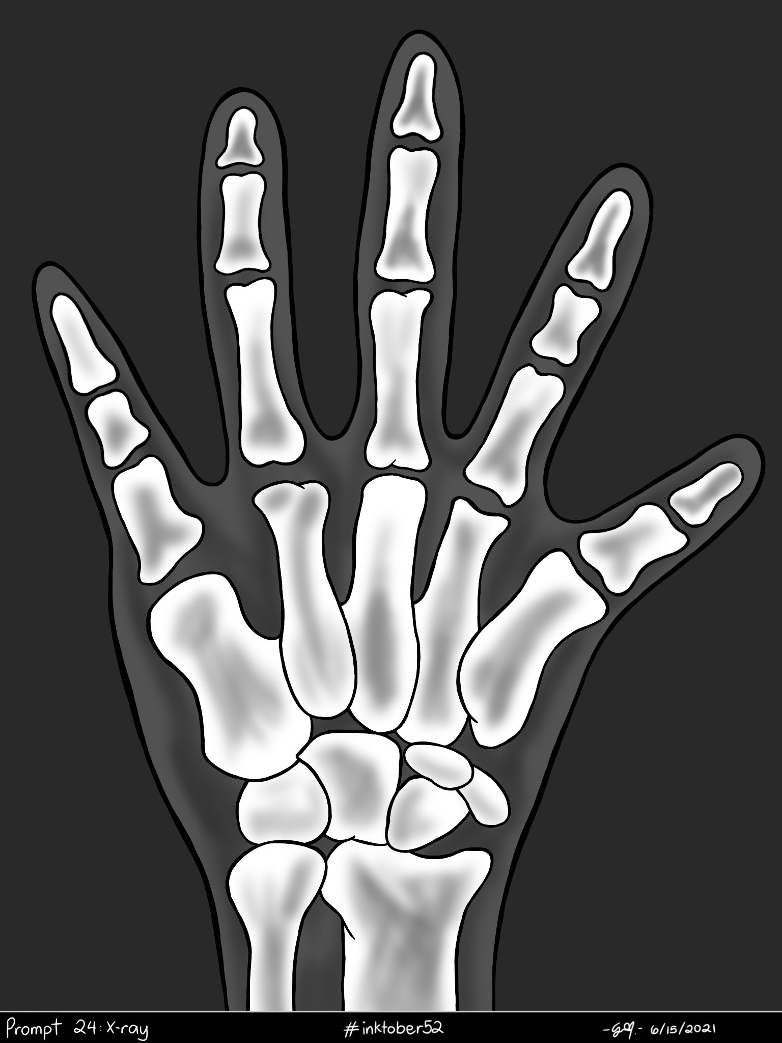 X Ray Hand Drawing