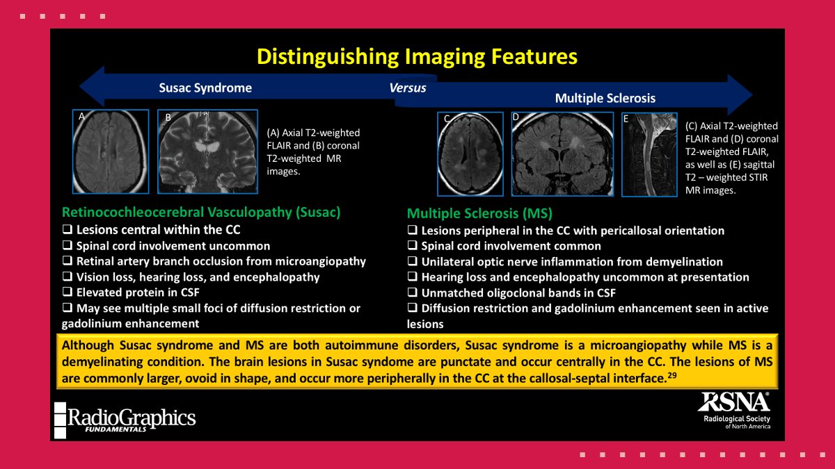 Differential Diagnosis of Corpus Callosum Lesions: Beyond the Typical ...