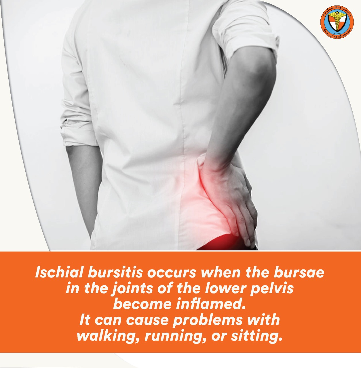 Ischial Pain When Sitting