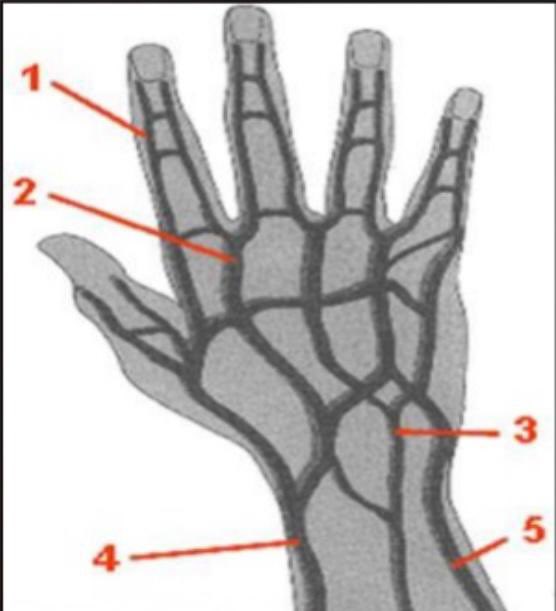 WHAT IS AN IV IVs act as a delivery system to introduce certain items ...