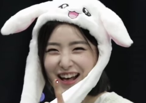 Teeth Lamination Kpop