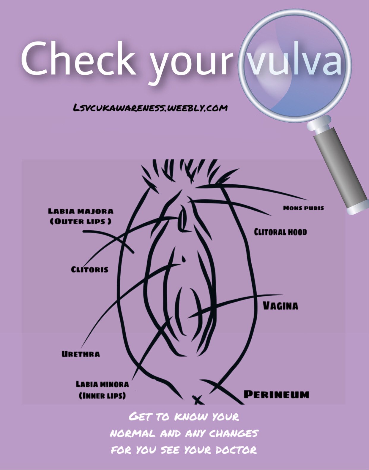 Normal Labia Minora Bumps BENIGN “LUMPS AND BUMPS” OF THE VULVA