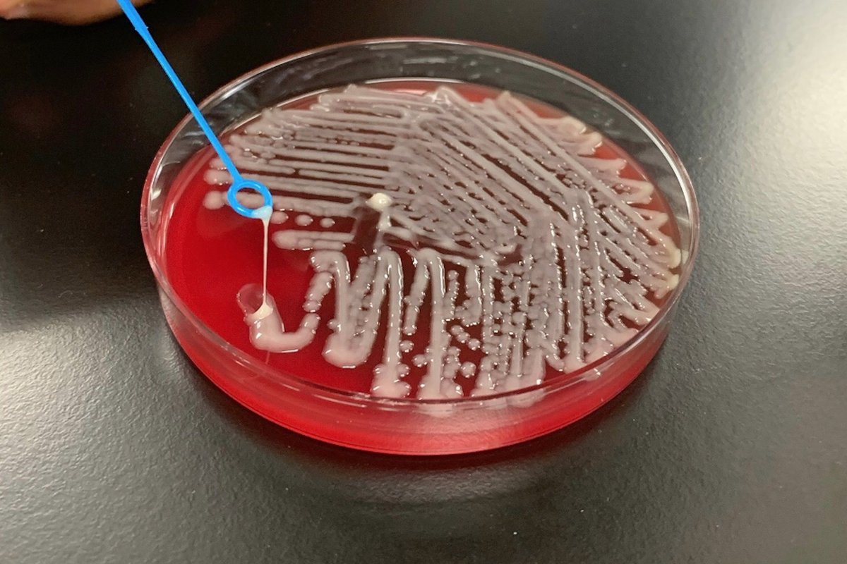 Klebsiella Pneumoniae Streak Plate