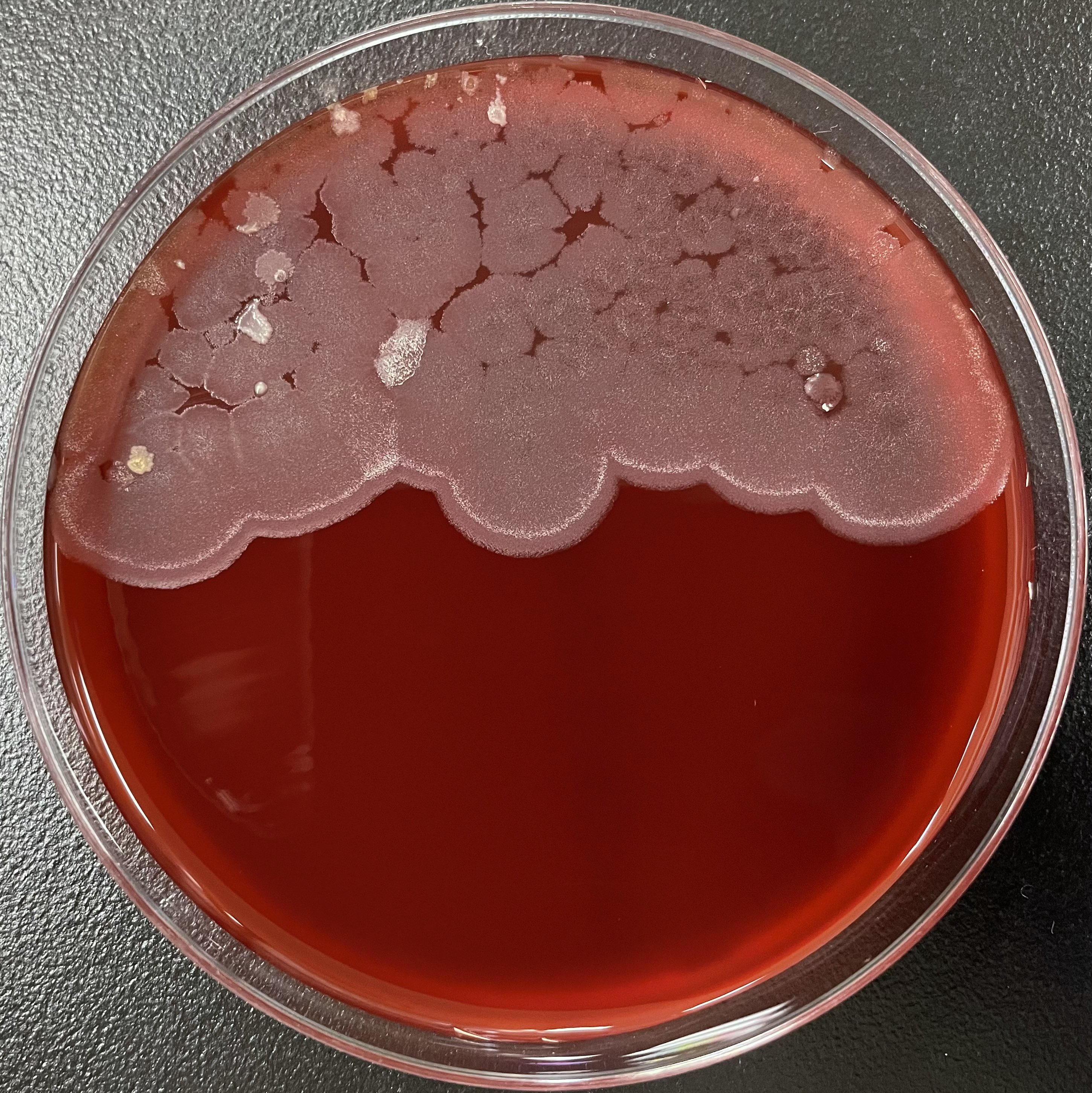 Bacillus Subtilis Blood Agar