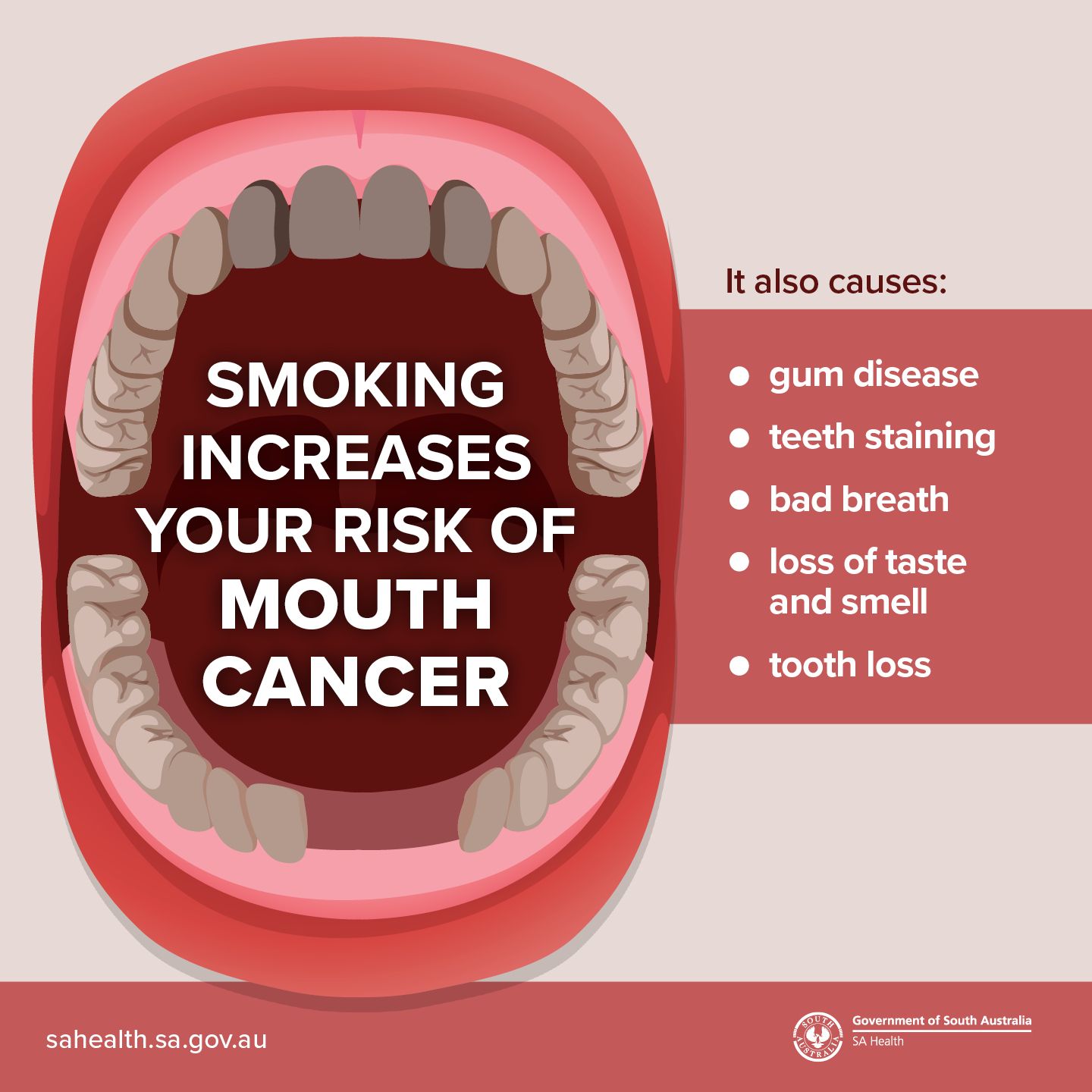 Tongue Cancer From Smoking