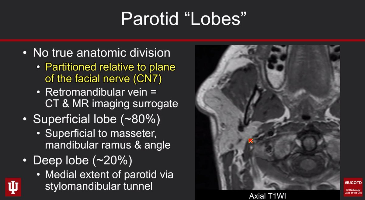 Retromandibular Vein Is Formed By