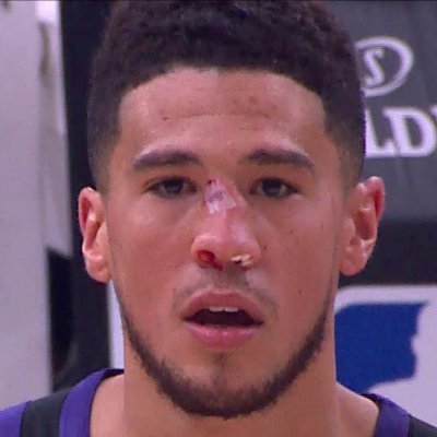 Steve Nash Broken Nose Video