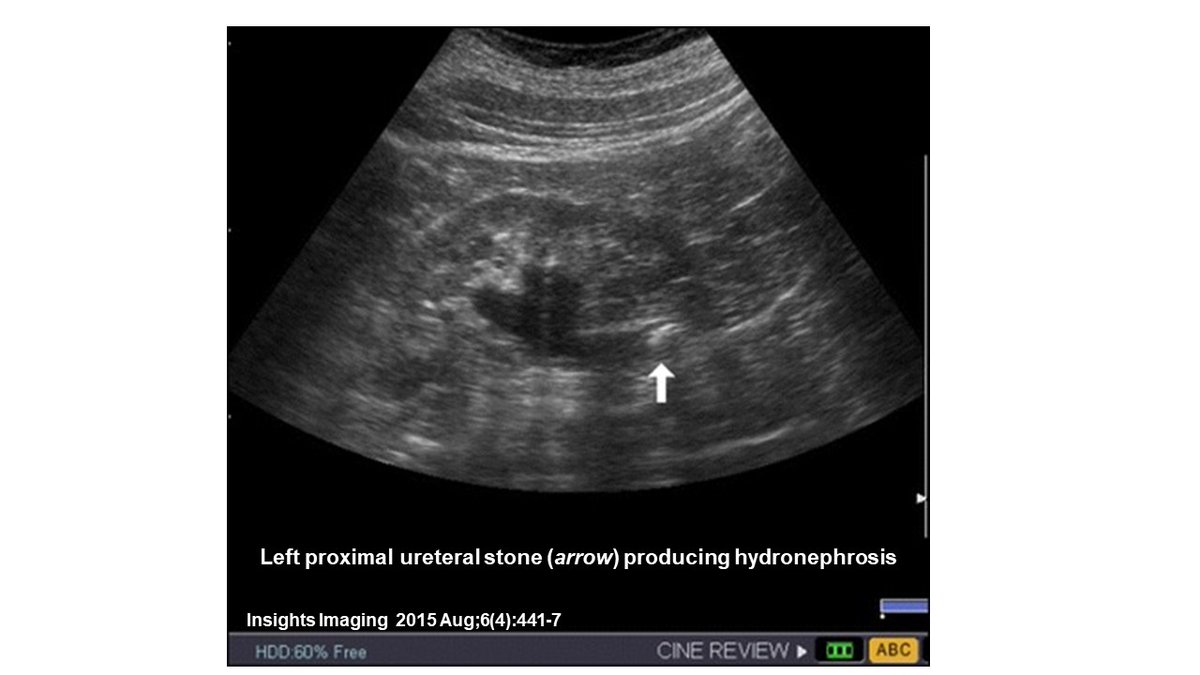 / Hello #MedTwitter This month’s @ASPNeph Imaging Webinar was about # ...