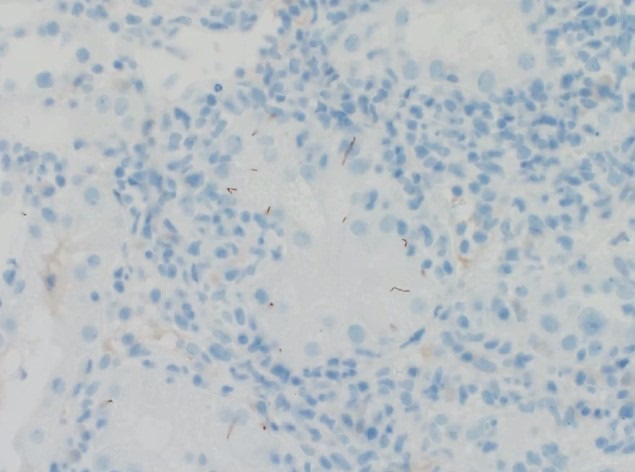 Images of Infectious Diseases @MayoMN_IMRes presented ID cases at # ...