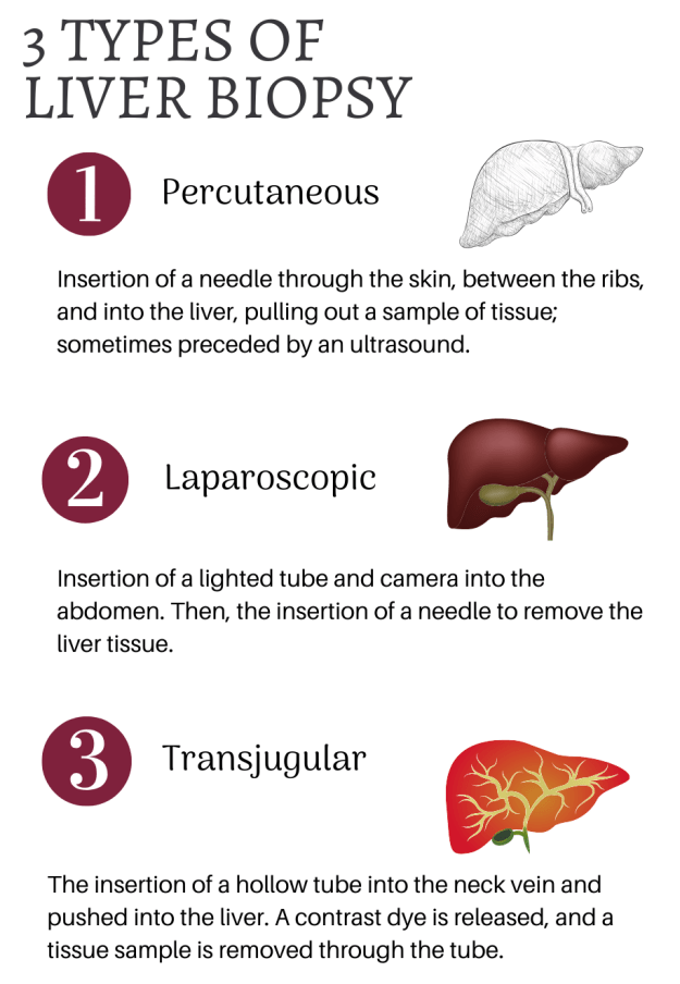 Liver Biopsy Procedure