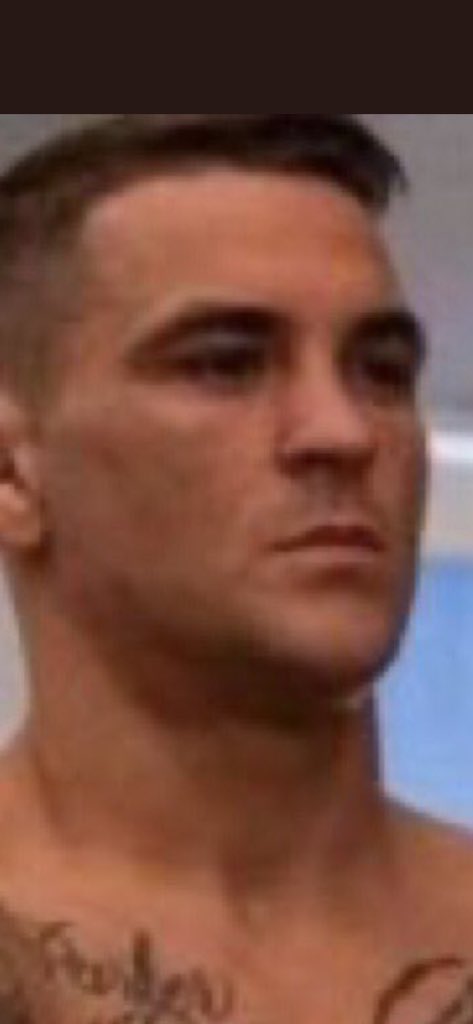 Stuart Campbell on Twitter: "@DustinPoirier @TheNotoriousMMA Hairline is pretty clapped too ...