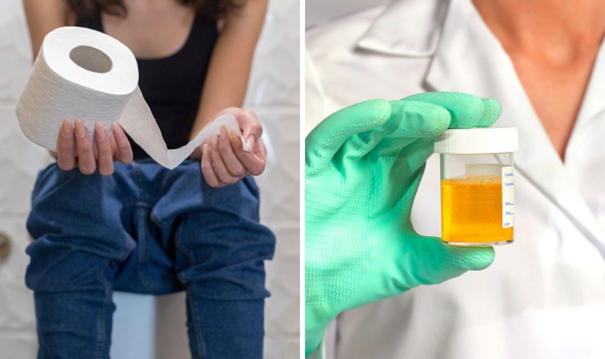 Wee colour chart: What YOUR urine colour says about your health | Daily ...